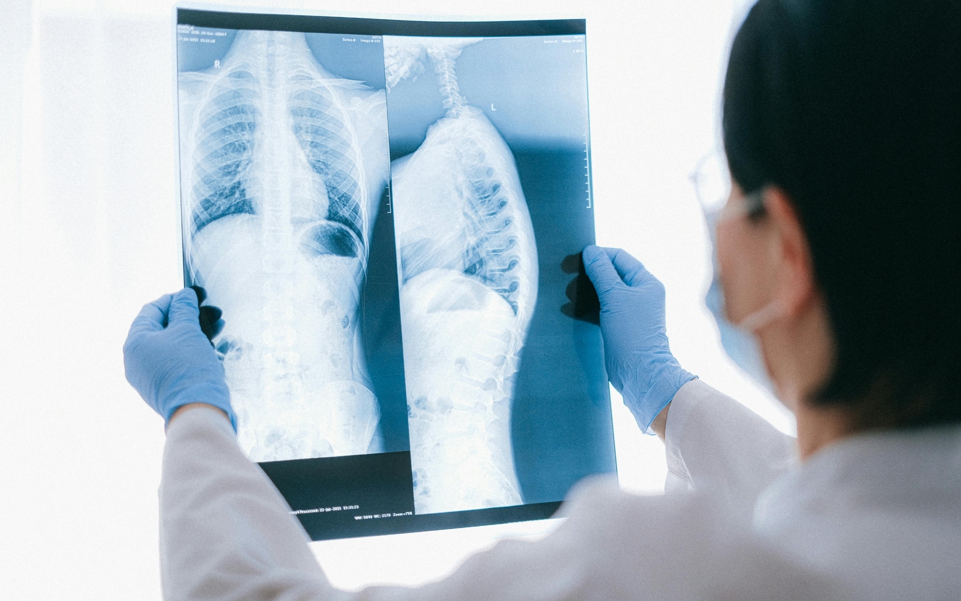 Dépenses de santé : les salaires des radiologues pointés du doigt